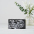 Ultrasound Sonographer Business Card | Zazzle
