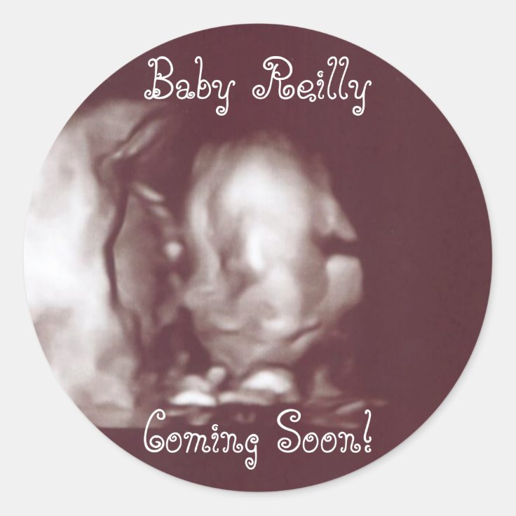 Ultrasound Sticker | Zazzle