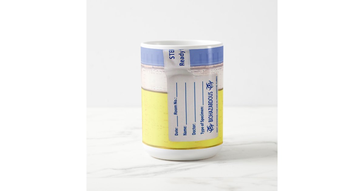Urine Specimen Coffee Mug | Zazzle
