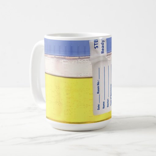 Urine Specimen Coffee Mug | Zazzle