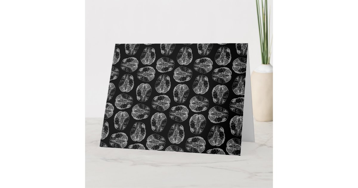 Vintage Brain Diagram Print Pattern Brains Black Thank You Card | Zazzle