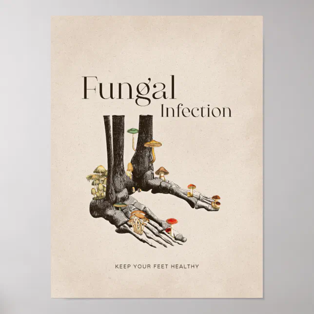 Vintage Fungal Infection Foot Care Poster | Zazzle