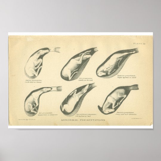 Vintage Horse Anatomy Print Foal Presentation | Zazzle.com