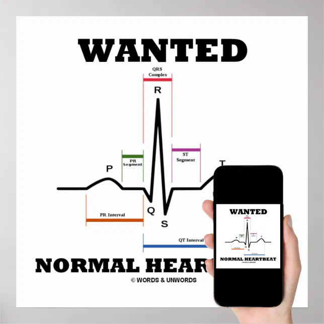 Wanted Normal Heartbeat ECG Electrocardiogram Poster | Zazzle