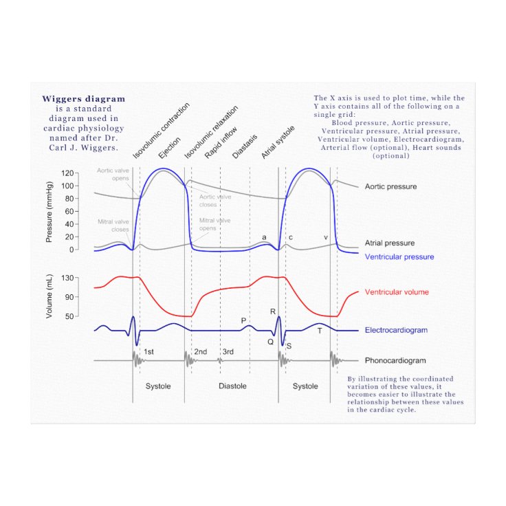 Wiggers Diagram Canvas Print | Zazzle
