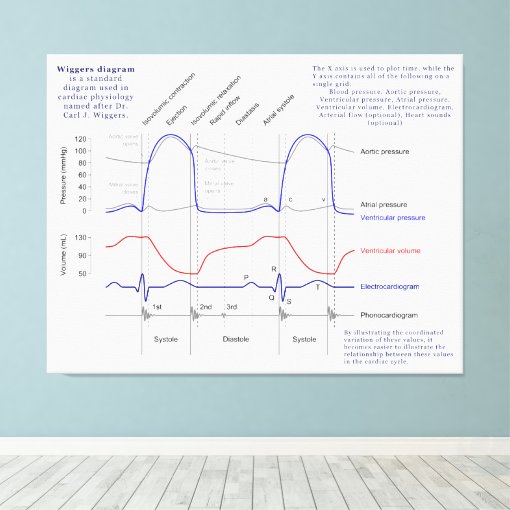 Wiggers Diagram Canvas Print | Zazzle