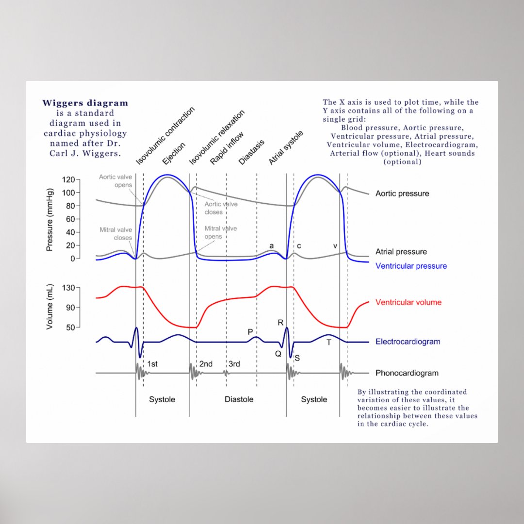 Wiggers Diagram Poster | Zazzle