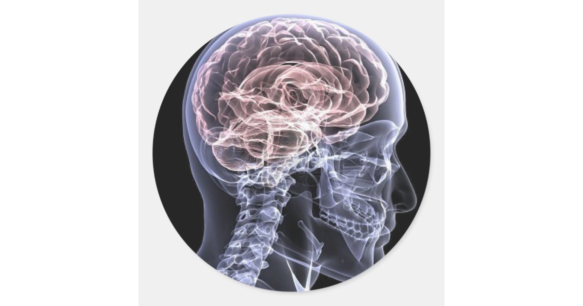 X-Ray Brain Classic Round Sticker | Zazzle
