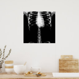 X-RAY SKELETON TORSO RIBS - B&W POSTER | Zazzle