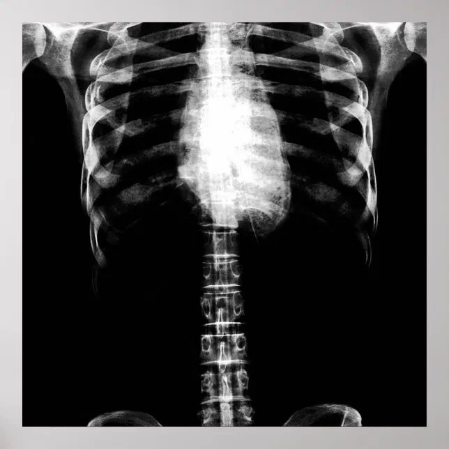 X-RAY SKELETON TORSO RIBS - B&W POSTER | Zazzle
