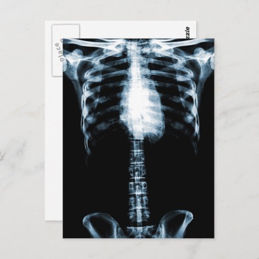 X-RAY SKELETON TORSO RIBS BLUE POSTCARD | Zazzle