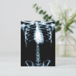 X-RAY SKELETON TORSO RIBS BLUE POSTCARD | Zazzle