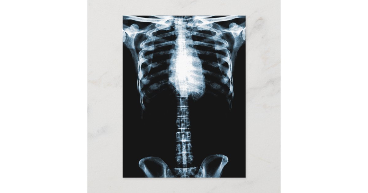 X-RAY SKELETON TORSO RIBS BLUE POSTCARD | Zazzle