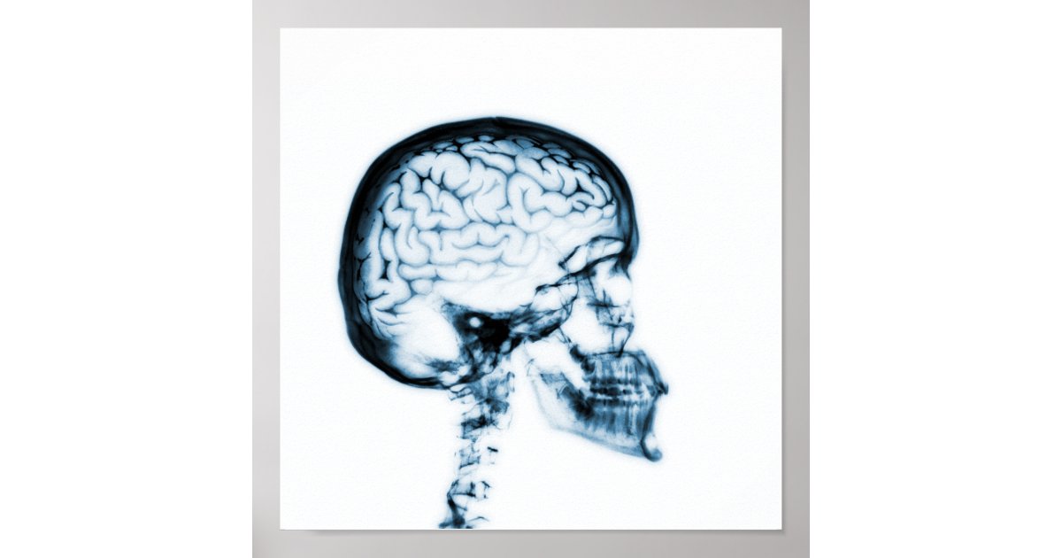 X-RAY SKULL BRAIN - BLUE POSTER | Zazzle