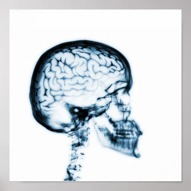 X-RAY SKULL BRAIN - BLUE POSTER | Zazzle