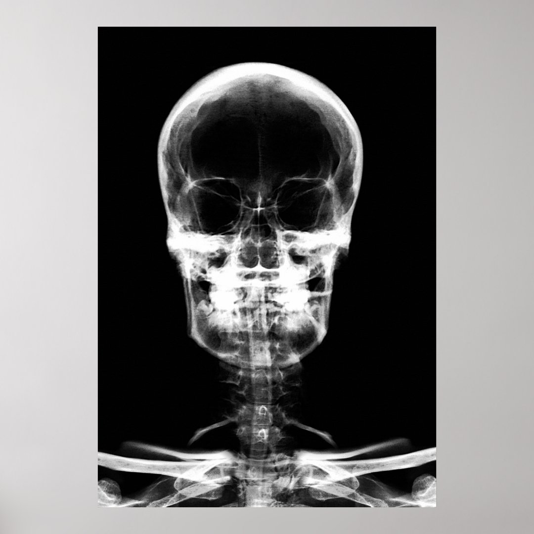 X-RAY VISION SKELETON SKULL - B&W POSTER | Zazzle